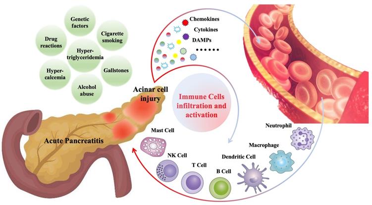 The Role of Pancreatic Infiltrating Innate Immune Cells in Acute ...