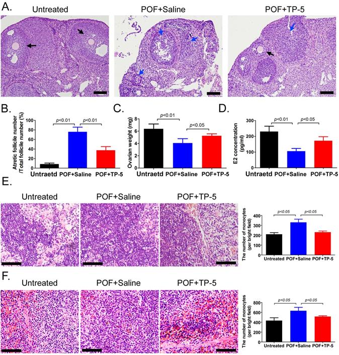 Thymopentin treatment of murine premature ovarian failure via ...